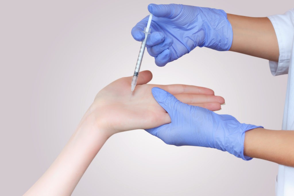 Botox Treatment: The Ultimate Solution for Underarm Sweating | Pudelek
